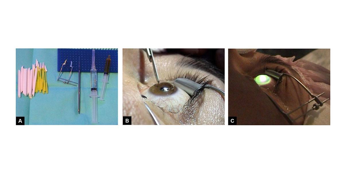 Cross-Linking review - The ELZA Institute