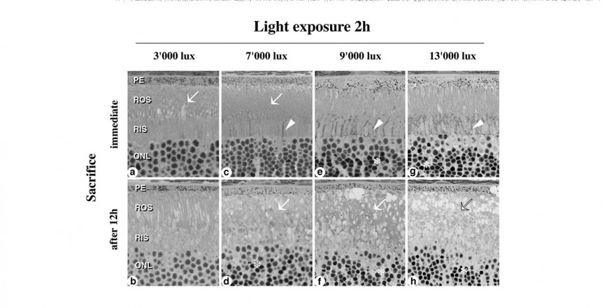 Apoptotic Cell Death in Retinal Degenerations - The ELZA Institute