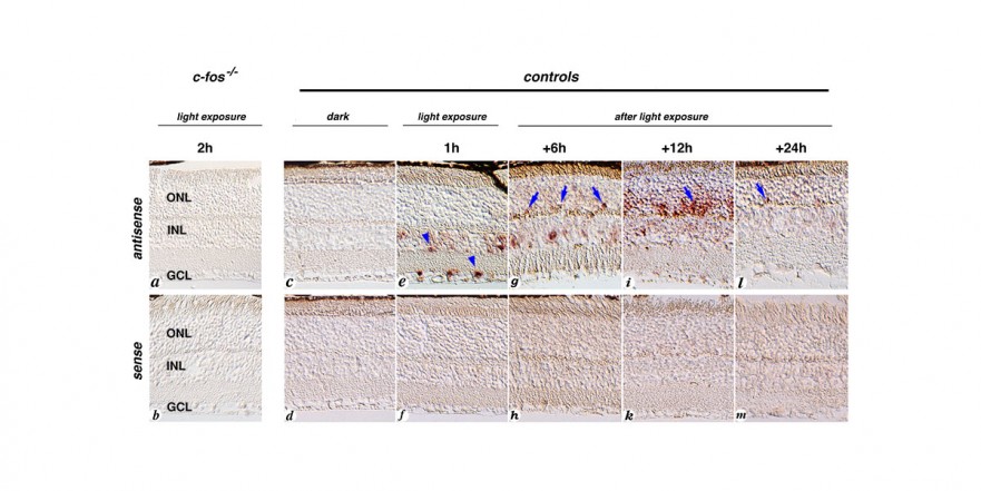 Retinal light damage and c-fos - The ELZA Institute