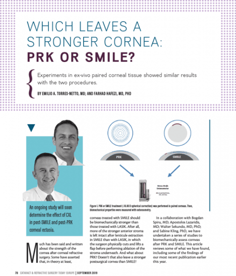Which is stronger? PRK or SMILE? Let's see what the experiments say!