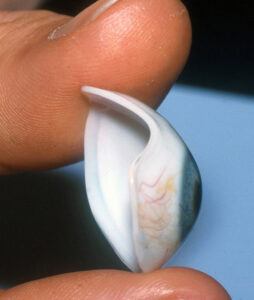 Enukleation und Eviszeration - Das ELZA Institut