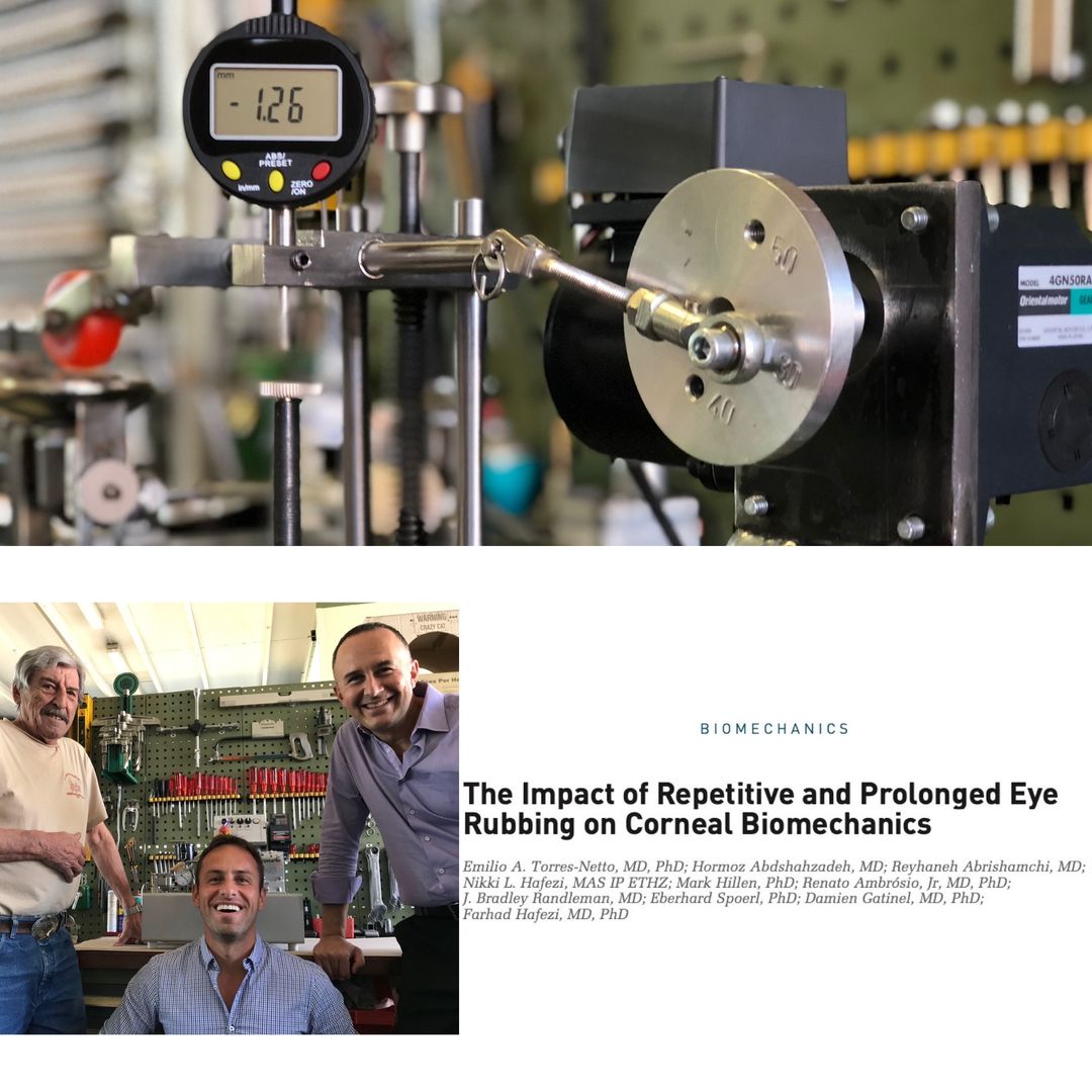 Eye rubbing and keratoconus: the forces applied when rubbing eyes