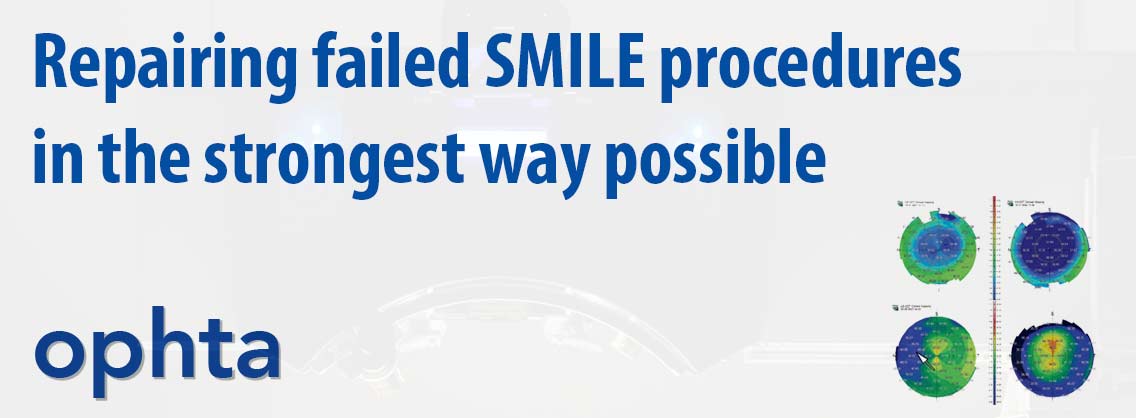 Repairing failed SMILE procedures in the strongest way possible - The ...