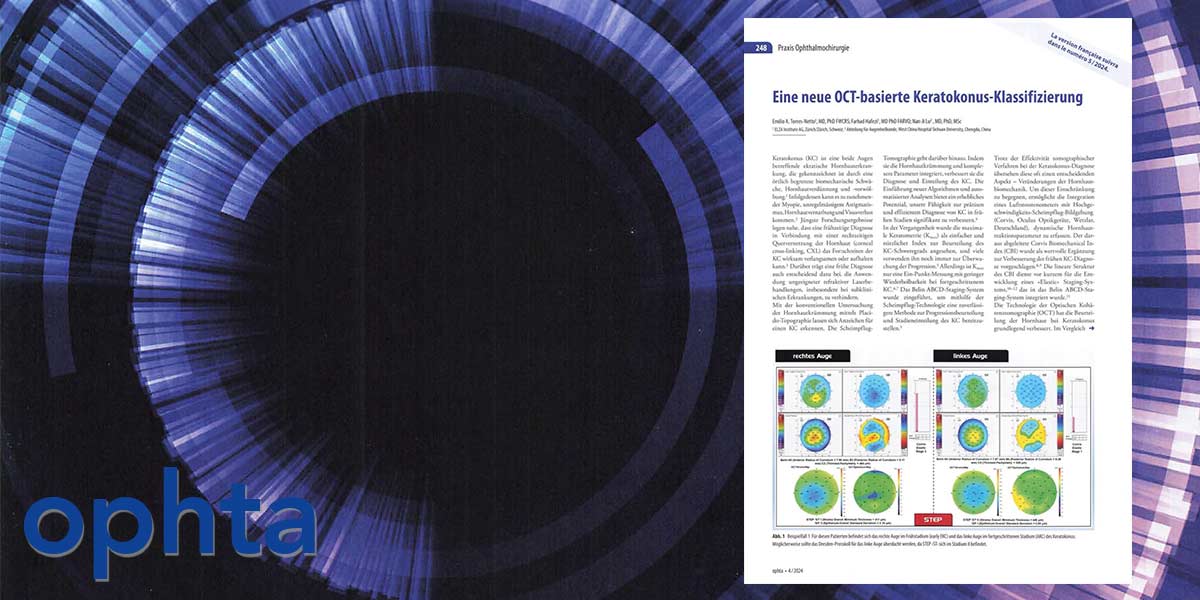 STEP: An OCT-Based Keratoconus Classification System - The ELZA Institute