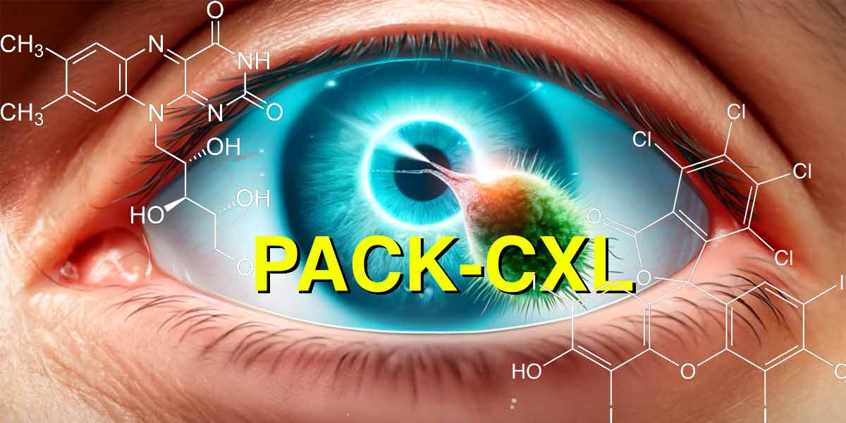 PACK-CXL com duplo cromóforo: Uma nova abordagem para o tratamento da ceratite por Acanthamoeba ...