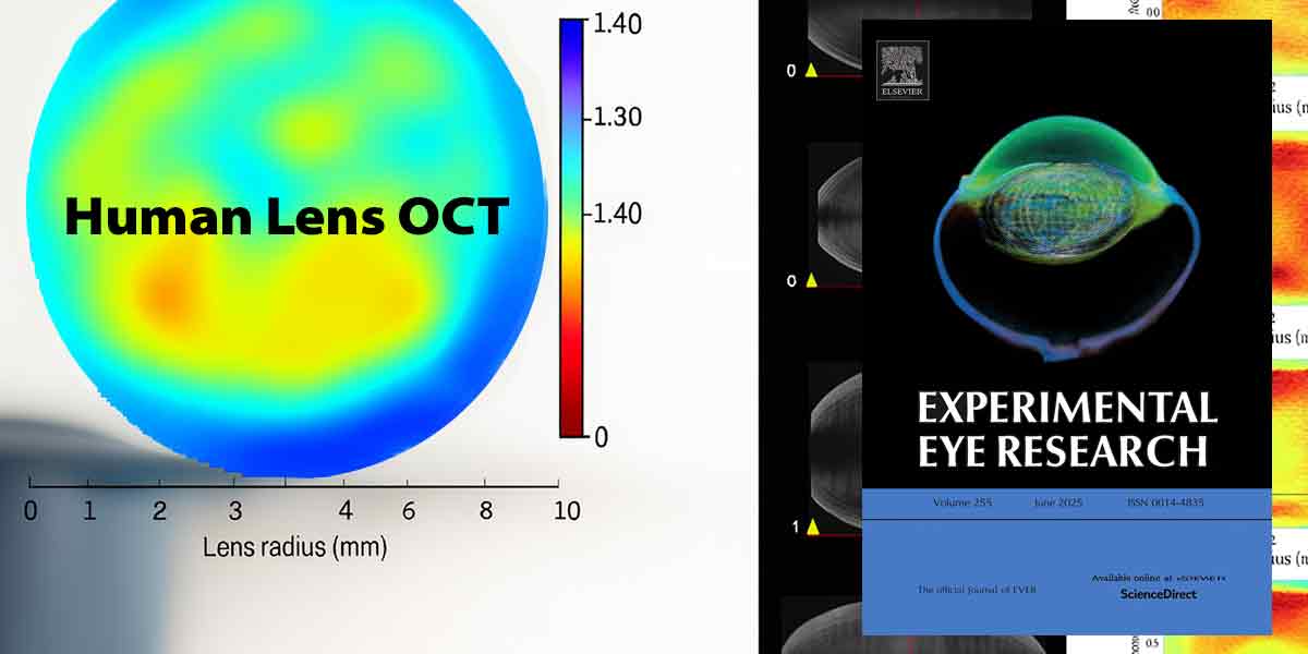 Human Lens OCT: Mapping Refractive Index and Strain in Action - The ...