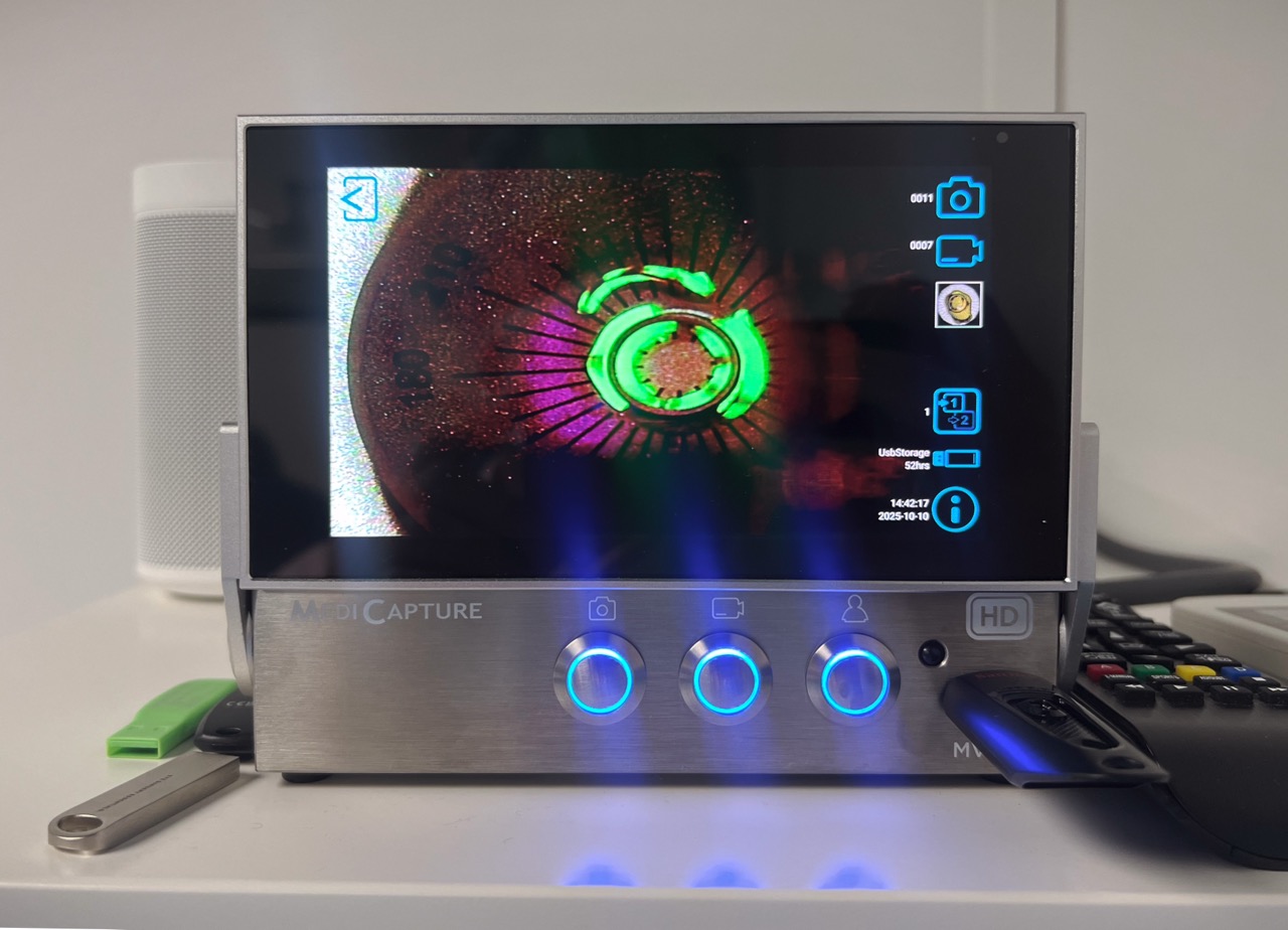 ECO-CAIRS Technique Published in the Journal of Refractive Surgery - The ELZA Institute