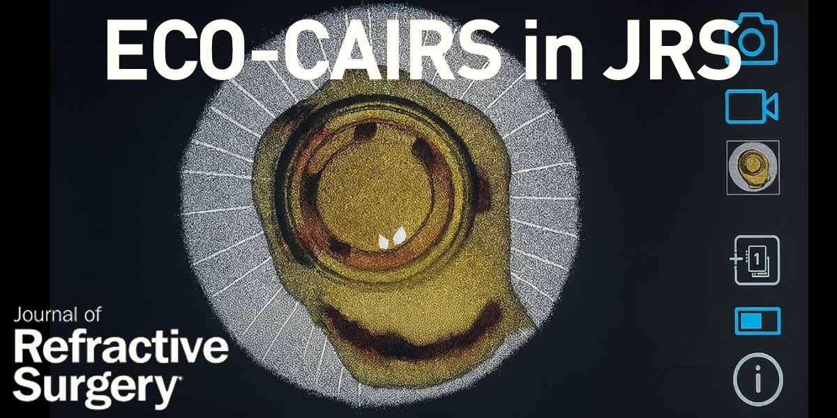 ECO-CAIRS Technique Published in the Journal of Refractive Surgery ...